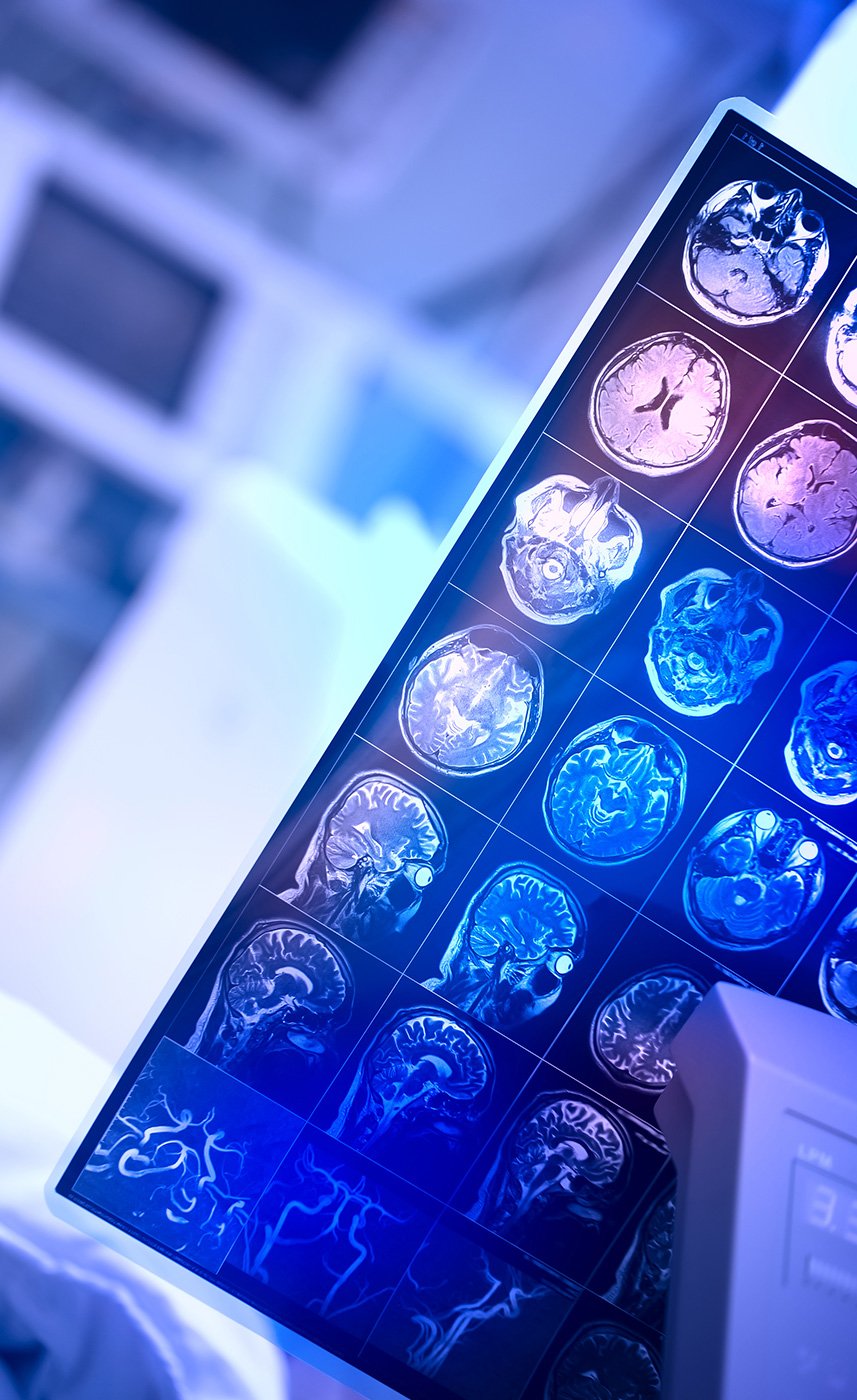 MRI for Canadians and Ontario Patients | Canmax Medical Imaging